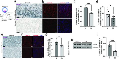 Lamin B1 Expression Is Reduced In T21 Primary Cells Representative Of