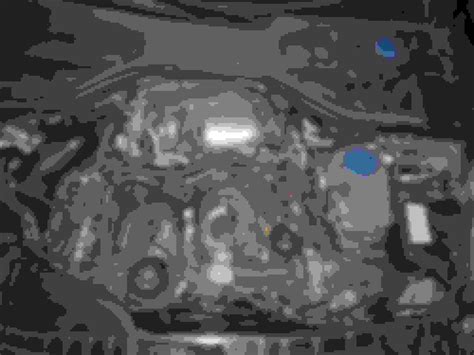 Nox Sensor Audiworld Forums