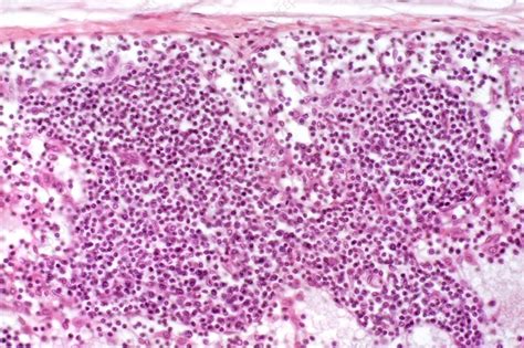 Lymph Node Light Micrograph Stock Image C Science Photo Library