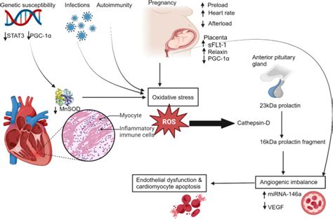 Peripartum Cardiomyopathy A Comprehensive And Contemporary Review Pmc