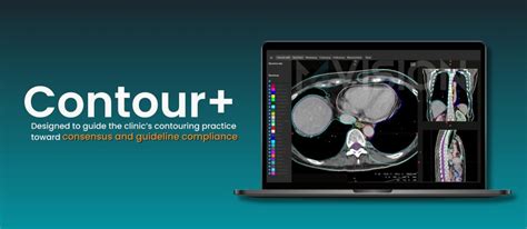 🎉 Exciting News Ai Auto Contouring Recommended By Nice For Radiotherapy In The Nhs 🎉 Mvision Ai