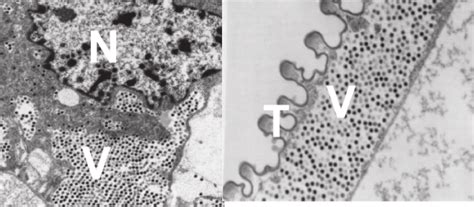 Transmission Electron Micrographs Showing Iridescent Virus 6 Inside