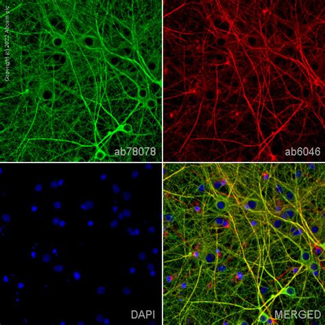 Anti Beta Iii Tubulin Antibody 2g10 Neuronal Marker Ko Tested Ab78078