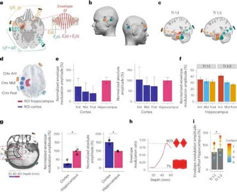 Temporal Interference Brain Stimulation Promising For Dementia Treatment