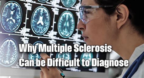 Why Multiple Sclerosis Can Be Difficult To Diagnose Mega Doctor News
