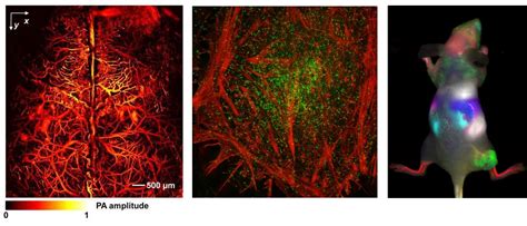 Biomedical And Molecular Imaging — Biomedical Engineering At Utsw