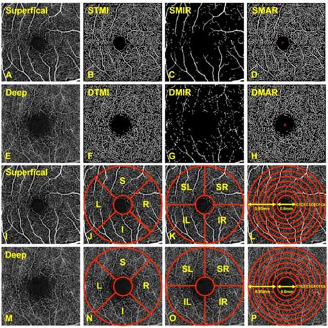 A H Optical Coherence Tomography Angiography Image Of The Macular Download Scientific Diagram