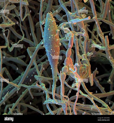 Skin Fungus Coloured Scanning Electron Micrograph Sem Of The Dermatophyte Fungus Microsporum