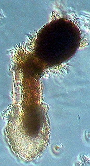 Morchella Under Microscope