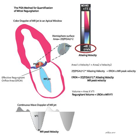 Aortic Valve Area Continuity Equation Tessshebaylo