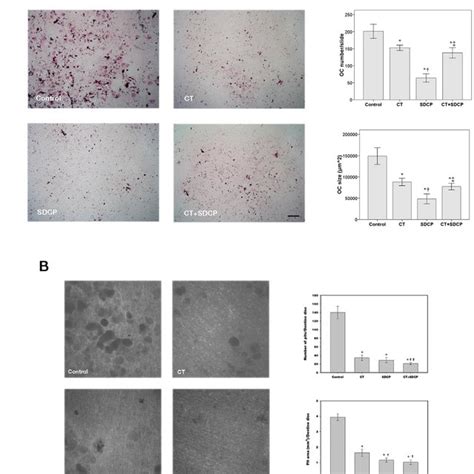 Calcitonin Inhibits Osteoclast Apoptosis Through Bcl 2 And Erk