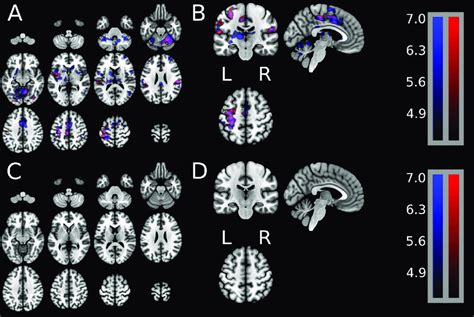 Group Level Glm Activation Maps Showing Unique Brain Activation Spatial Download Scientific