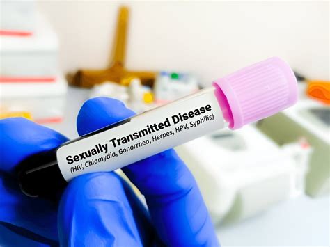 Where Can I Get An Std Test In Delhi How Much Does An Std Test Cost