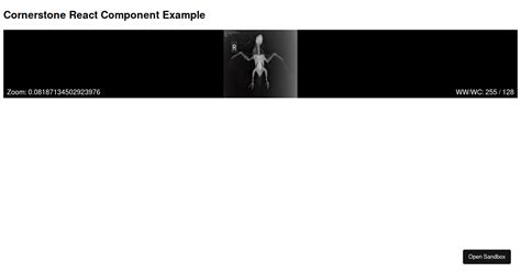 cornerstone react component example codesandbox
