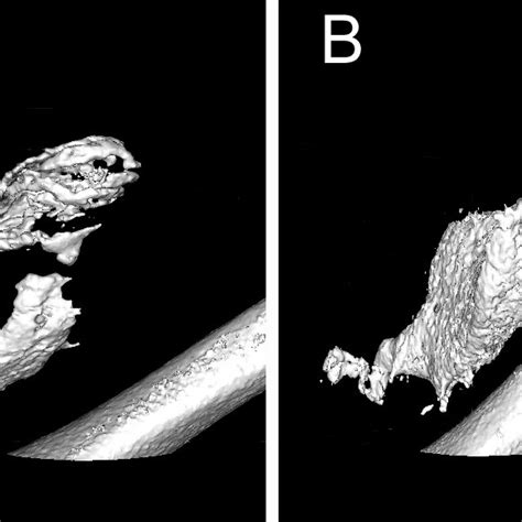 3d Surface Rendering Computerized Tomographic Reconstruction Showing