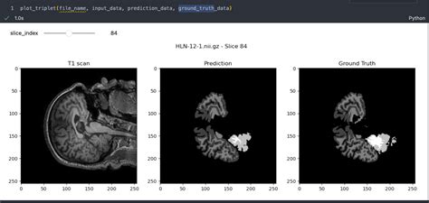 The Ultimate Guide To Nnu Net For State Of The Art Image Segmentation