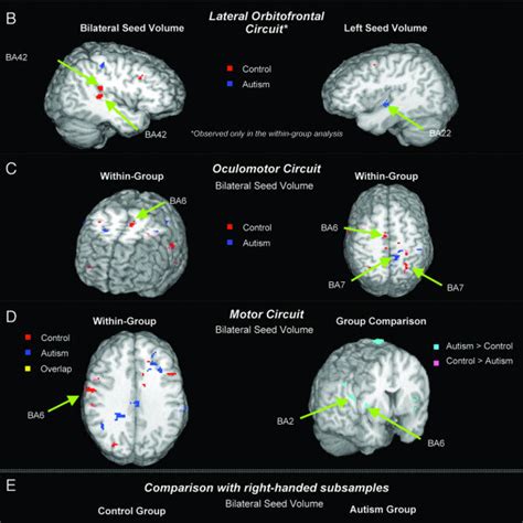 Functional Connectivity MRI Effects Functional Connectivity Clusters Download Scientific