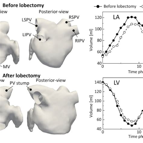 Left Atrium La Surfaces At Phase 0 Left And Time Courses Of The Download Scientific