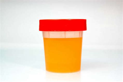 The Dangers Of Dehydration