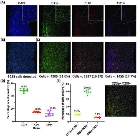 Cellprofiler Quantification Of Images And Cell Segmentation