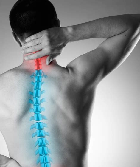 Cervical Osteoarthritis Wascher Spine Institute