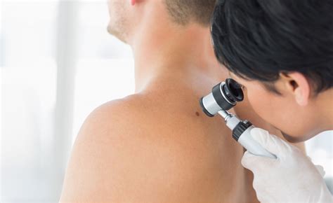 Squamous Cell Carcinoma Treatment Alternative To Mohs Surgery