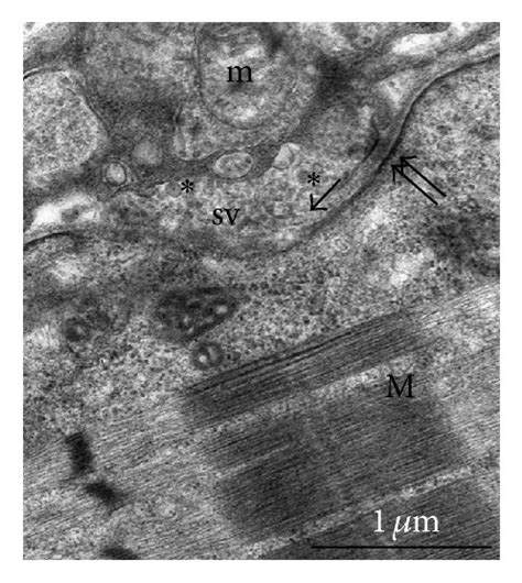 Electron Micrographs Of Neuromuscular Junction Nmj And Synaptic