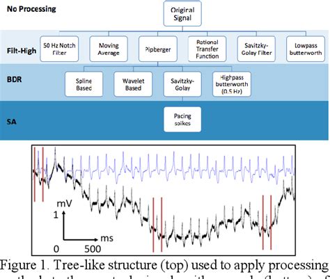 Figure 1 From Effects Of Ecg Signal Processing On The Inverse Problem Of Electrocardiography