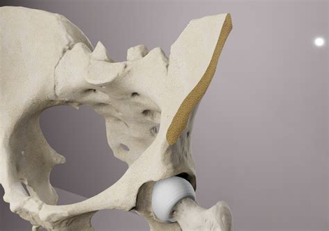 Cross Section Of Bone Cgtrader