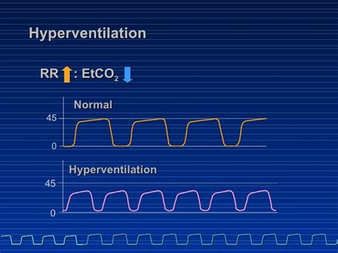 15 Capnography Part2 Introduction