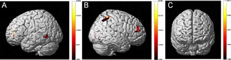 Neural Activation Of Early Exposed Bilingual Adults As Compared To Download Scientific Diagram