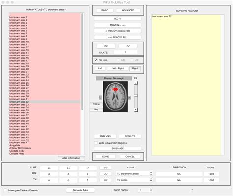 SPM Tutorial 9 ROI Analysis Andy S Brain Book 1 0 Documentation