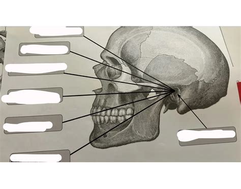 Positioning Landmarks For Skull Quiz