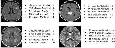Mathematics Free Full Text An Ensemble Classification Method For Brain Tumor Images Using