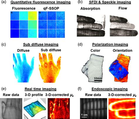Spatial Frequency Domain Imaging In Principles Applications And Perspectives