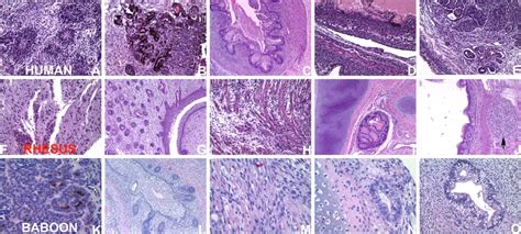Teratomas Derived From Embryonic Stem Cells As Models For Embryonic Teratomas Derived From Embryonic Stem Cells As Models For Embryonic