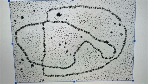 Solved Consider This Electron Micrograph Image Explain How