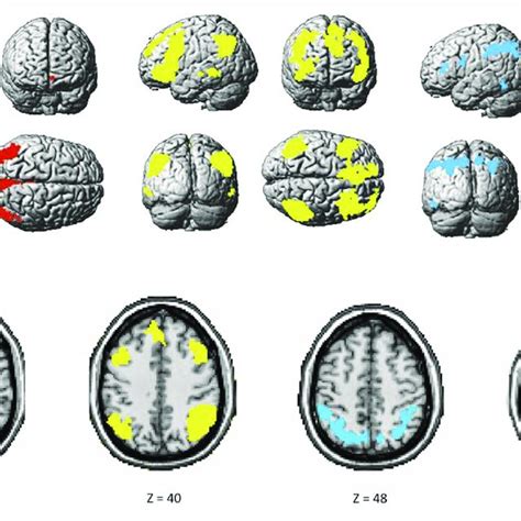 A Maps Of The Default Mode Dmn Red Bilateral Frontoparietal Download Scientific Diagram