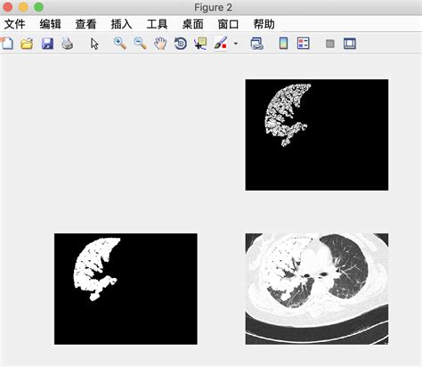 七、opencv学习笔记——区域生长算法opencv 区域生长算法 Csdn博客
