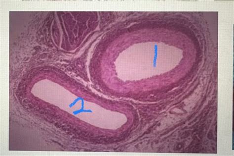 Lab Exam 2 Flashcards Quizlet