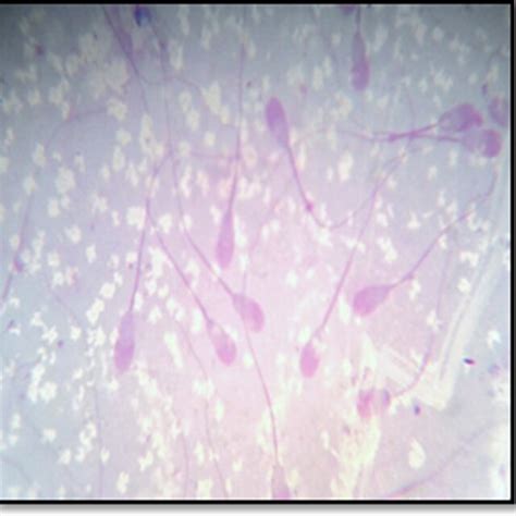 Spermatozoa With Intact Acrosome Reacted Giemsa Stain 100x Download Scientific Diagram