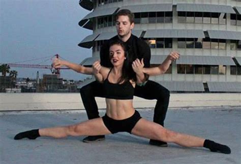 Professional Dancer Cassandra Naud With Huge Birthmark On Her Face