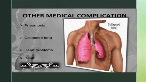 Chronic Obstructive Pulmonary Disease And Pneumonia Pptx