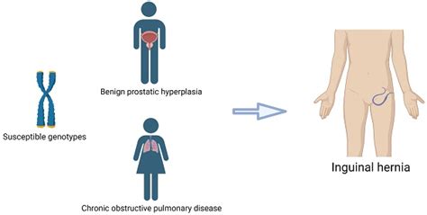 E78 5 Icd Sex Specific Genetic Variants Associated With Adult Onset