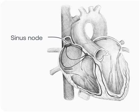 Eko Sinus Node And Atrial Depolarization