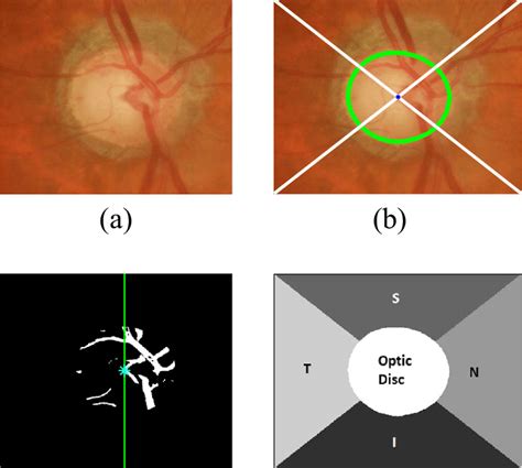 Different Regions Of The Optic Disc Centred Image With A Image Of A