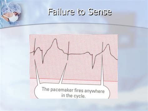 Temporary Pacemaker Slides