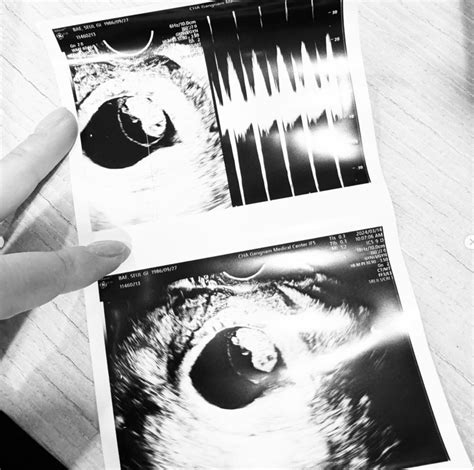 배슬기♥심리섭 결혼 4년만에 임신 9주차…태명은 리슬 네이트 연예