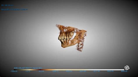 Ahmed Abdelkarim On Linkedin Segmentation 3dprinting 14 Comments