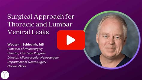 Schievink3 Play Spinal Csf Leak Foundation